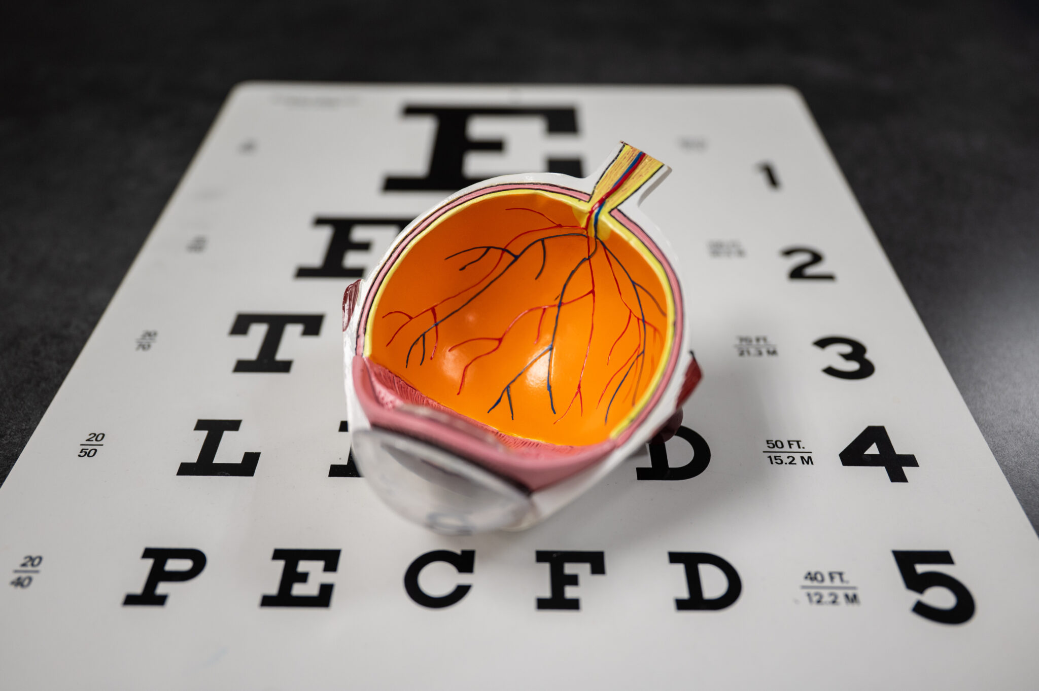 Concussion and TBI – Vision Parkridge